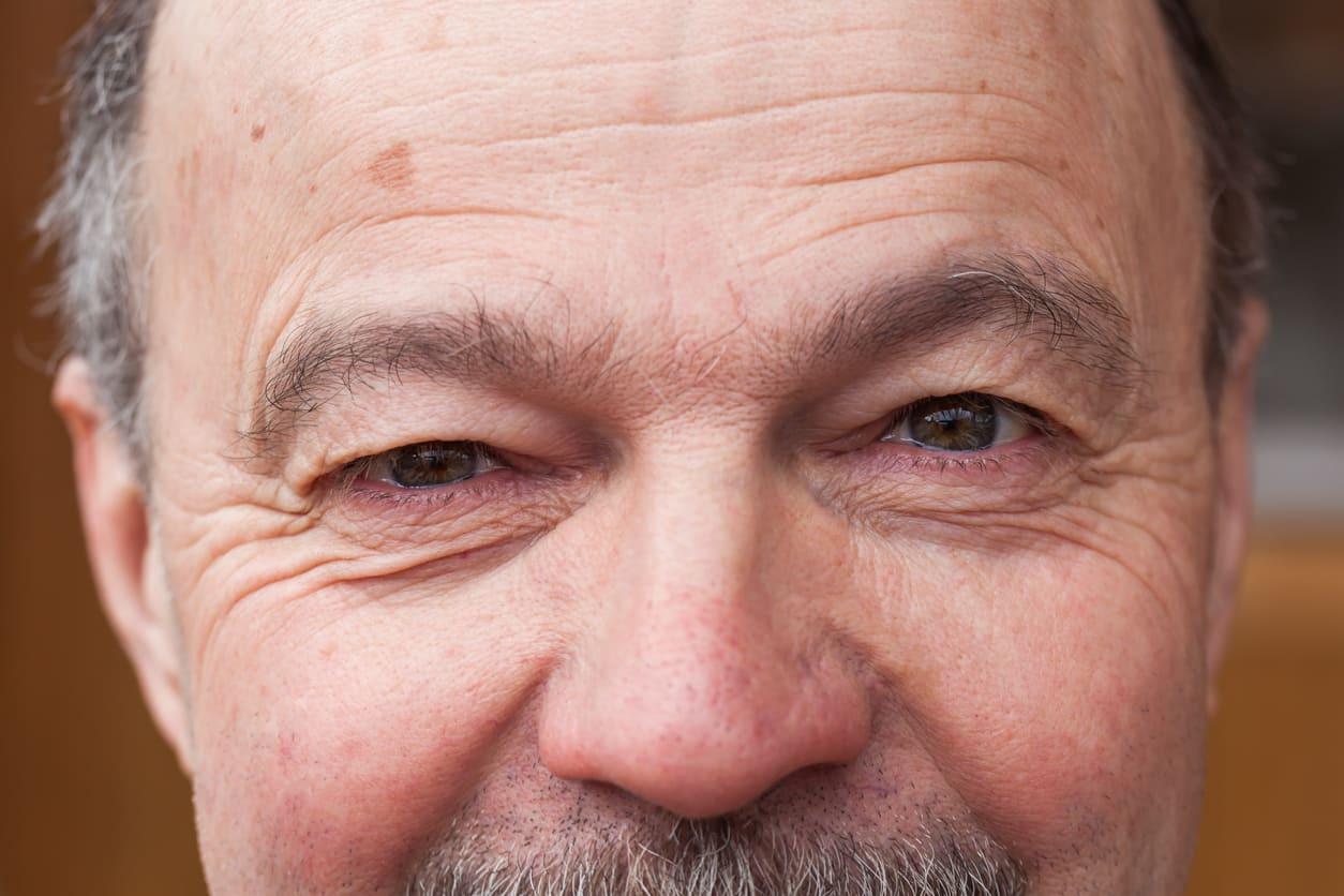 11 Bentuk Hidung dan Hubungannya dengan Kepribadian Pemiliknya