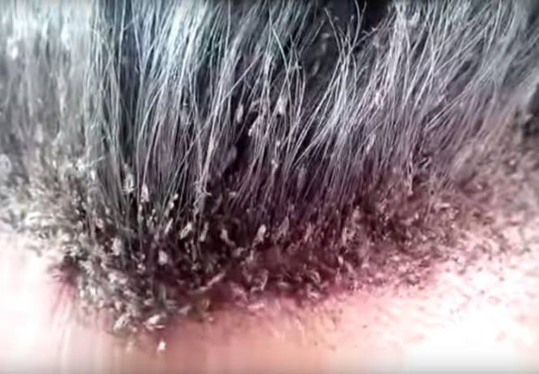 Contoh Simbiosis Parasitisme dan Ciri-Ciri Makhluk Hidup Lainnya - Best ...