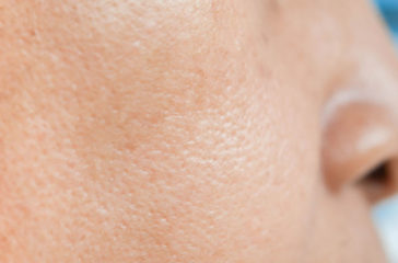 16 Cara Mengecilkan Pori-Pori Wajah Agar Terlihat Mulus!